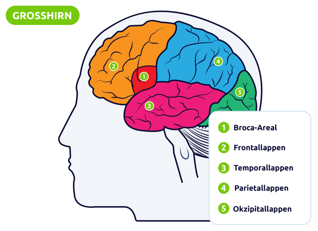 Broca-Aphasie | Pflegerio