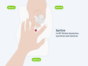 Ventrogluteale Injektion nach Hochstetter | Pflegerio