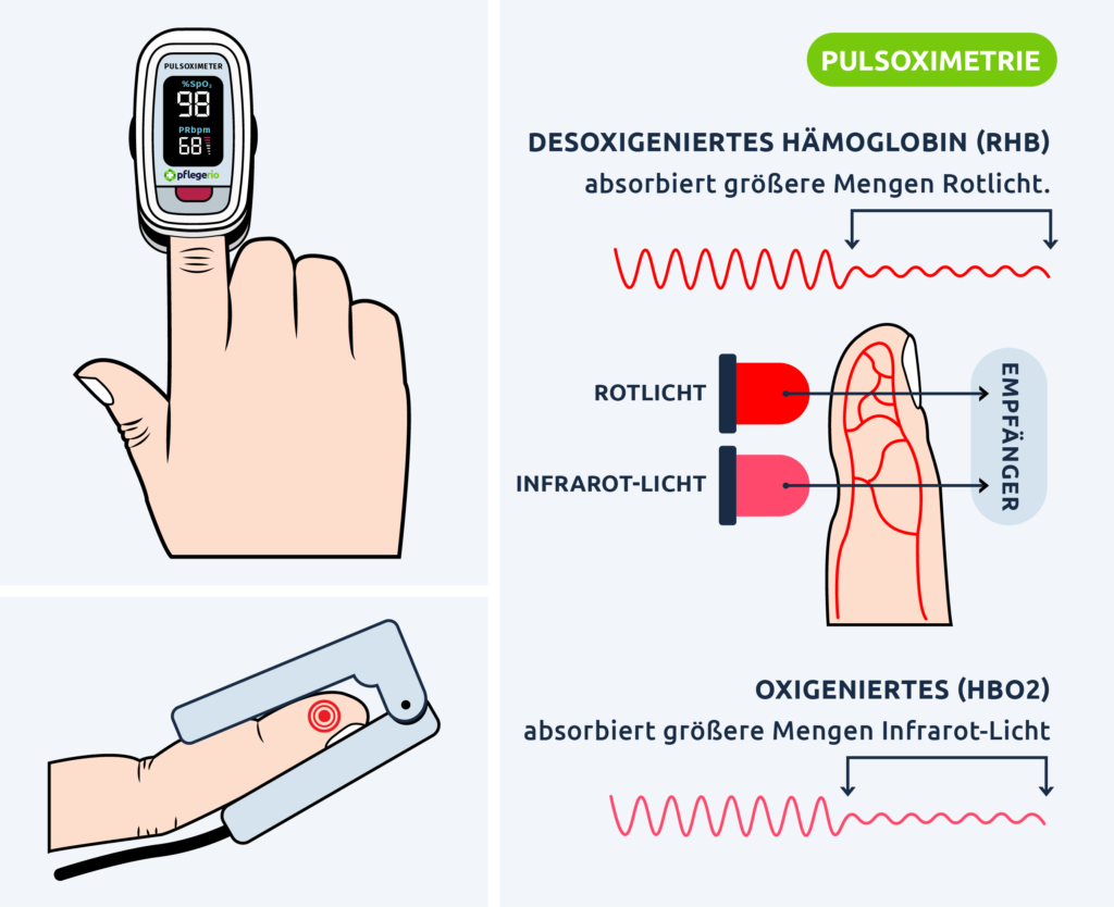 Pulsoximetrie | Pflegerio
