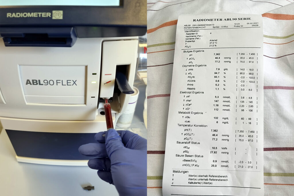 Blutgasanalyse | Pflegerio