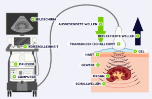 Sonografie (Ultraschall) | Pflegerio