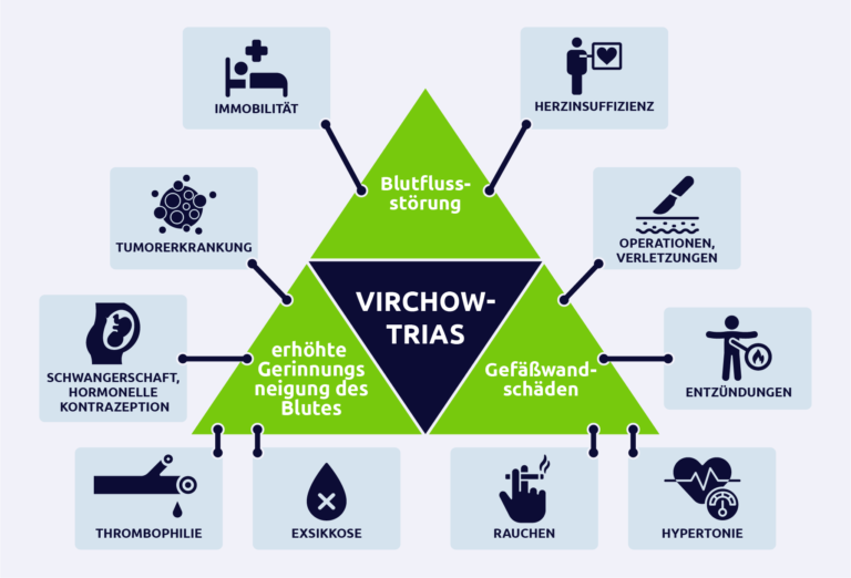 Virchow-Trias | Pflegerio